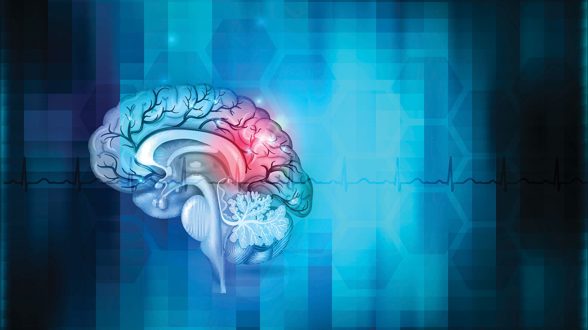 Aphasia Now Aphasia Now